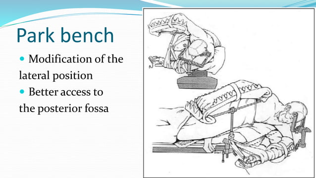 Positioning in neurosurgery | PPTX | Death, Injury, or Military ...