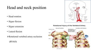 Positioning neurosurgery | PPTX