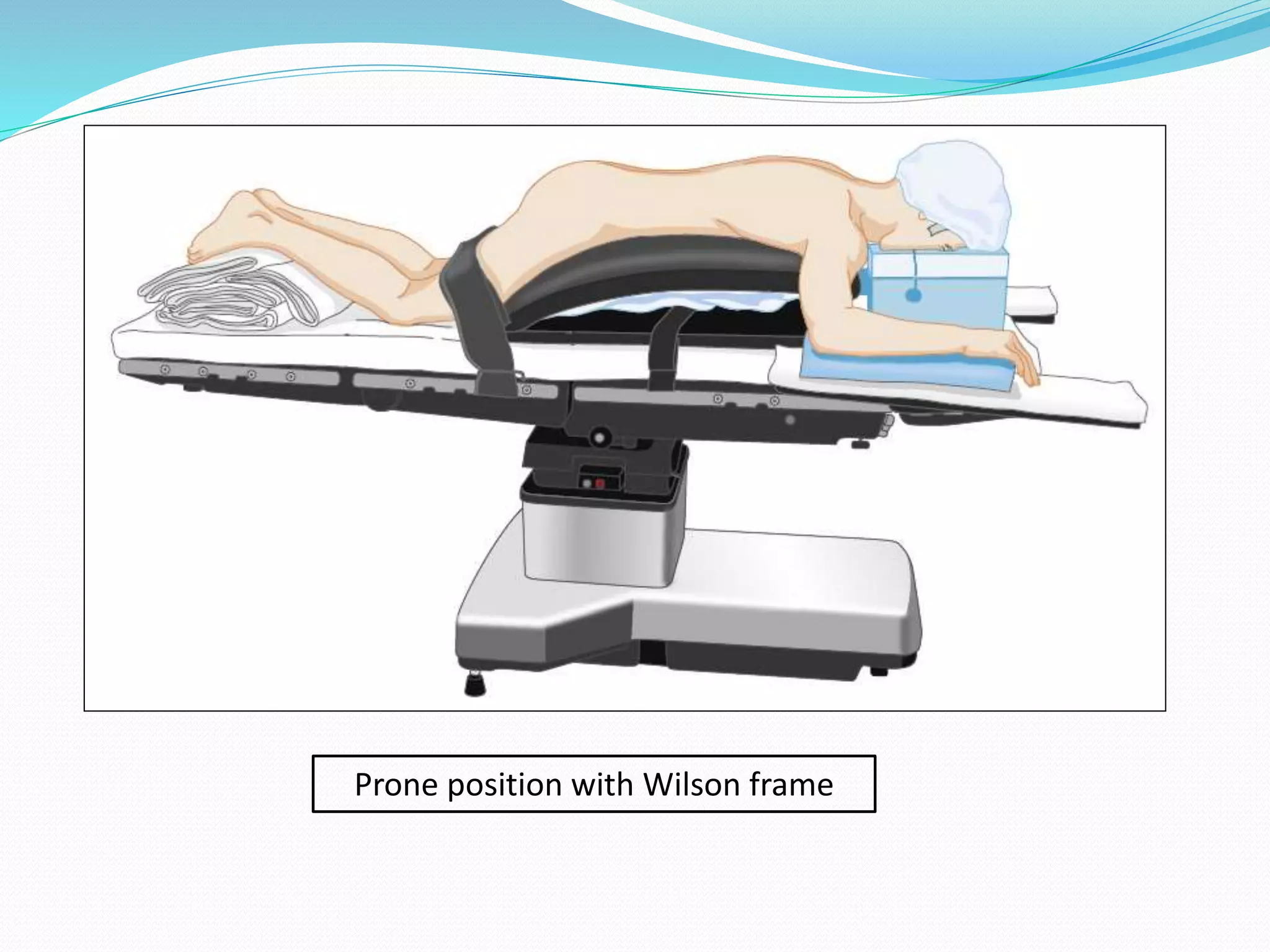 Positioning in neurosurgical procedures | PPTX