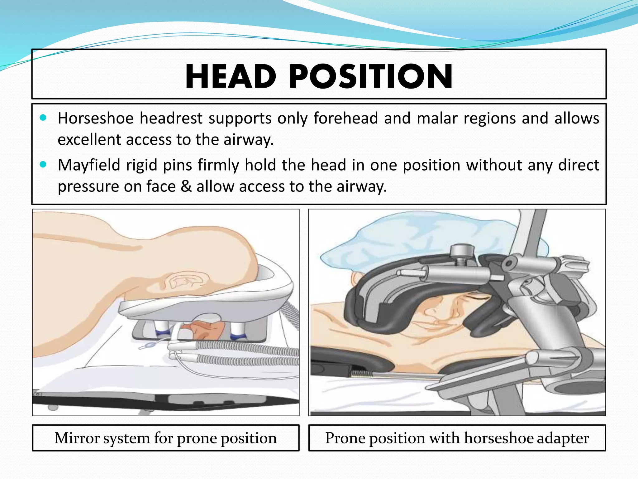Positioning in neurosurgical procedures | PPTX