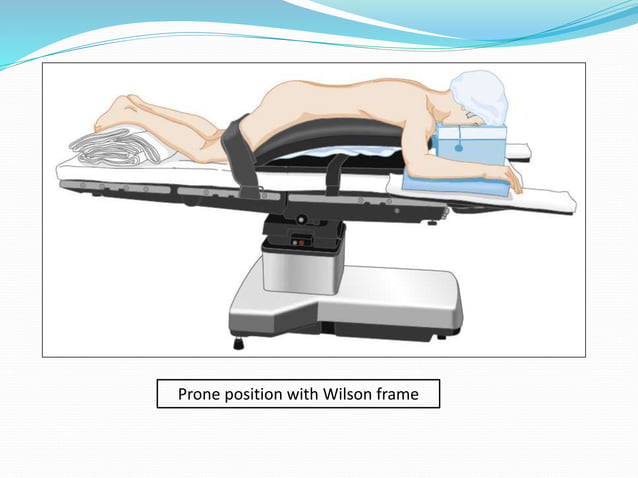 Positioning in neurosurgical procedures | PPTX | Death, Injury, or ...