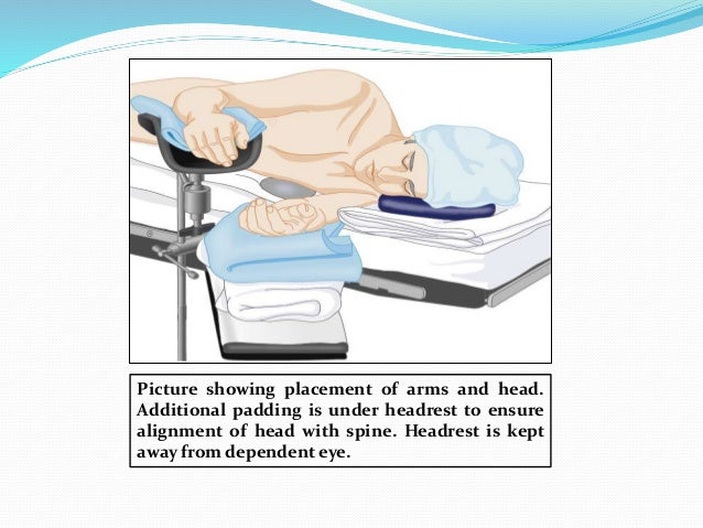 Positioning in neurosurgical procedures
