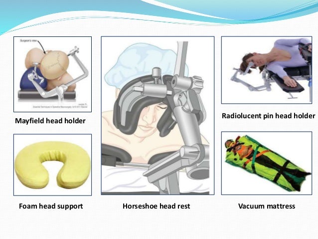 Positioning in neurosurgical procedures