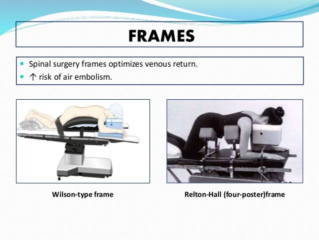 Positioning in neurosurgical procedures