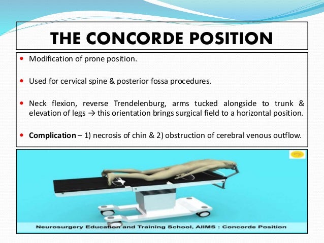 Positioning in neurosurgical procedures