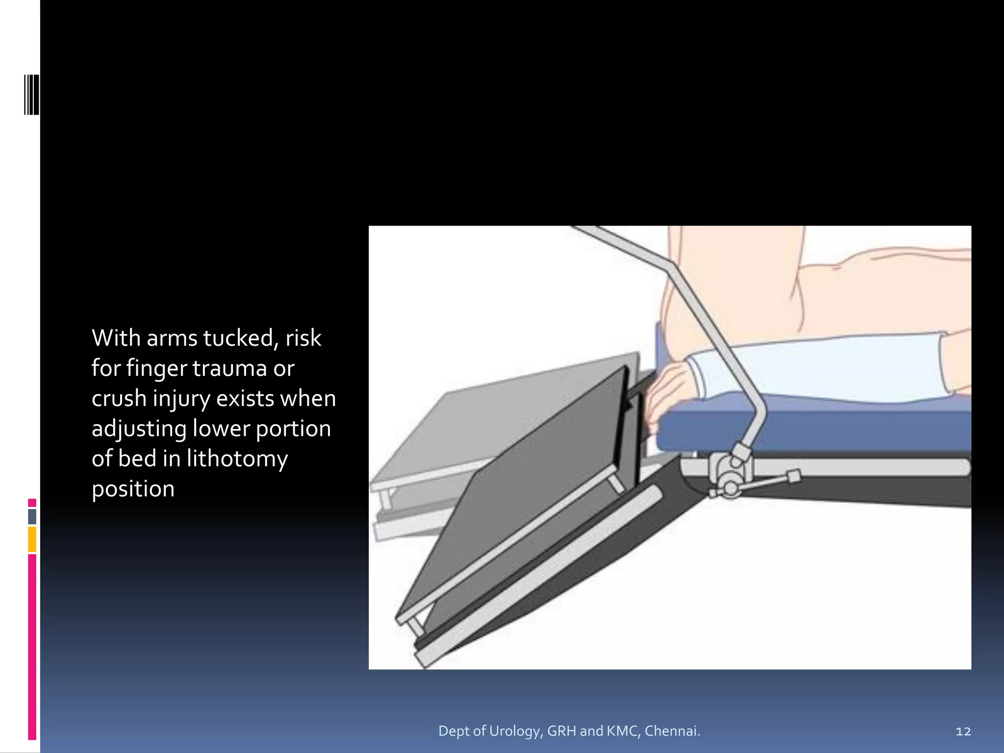 Positioning in urological procedures | PDF