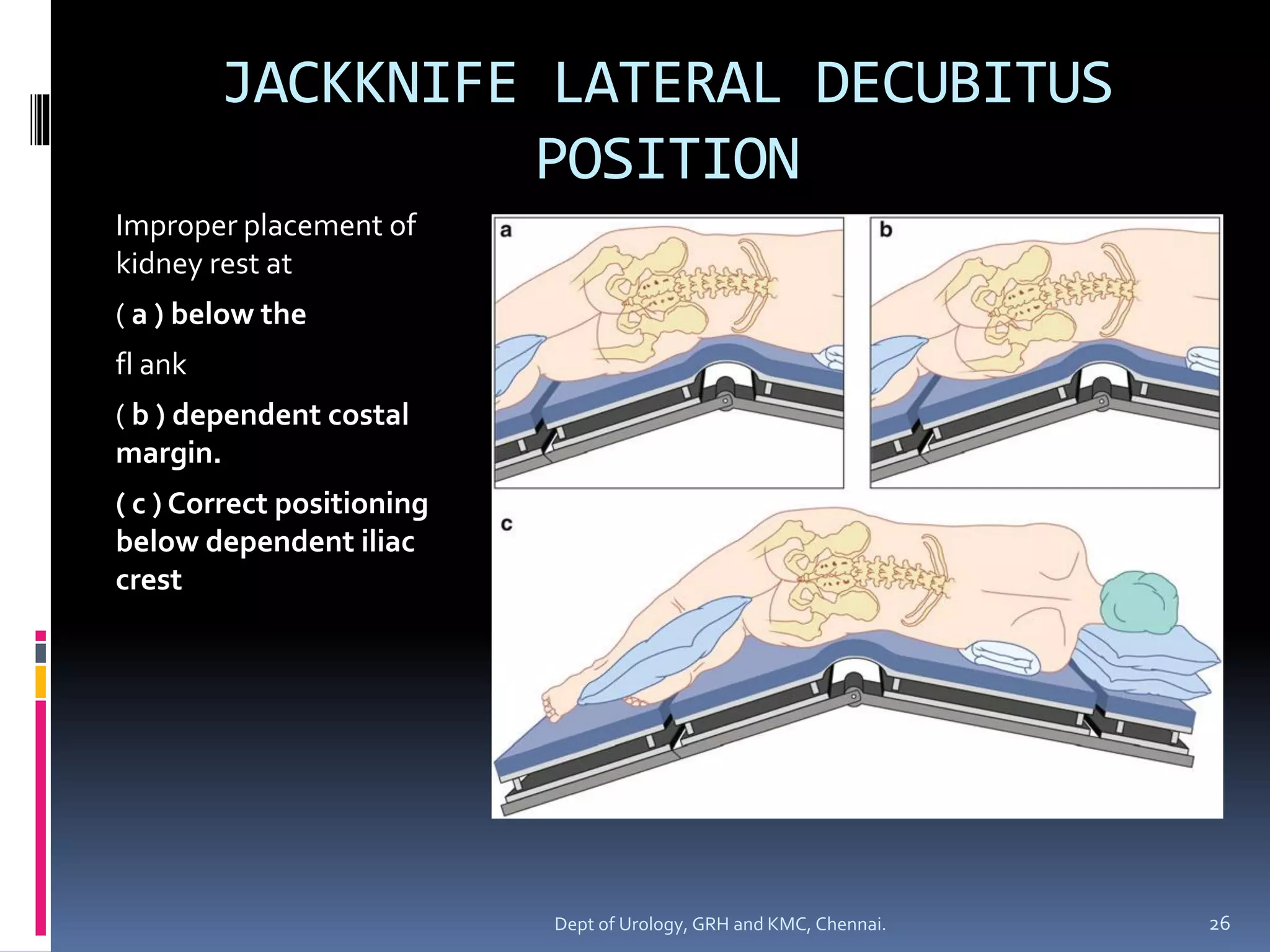 Positioning in urological procedures | PDF