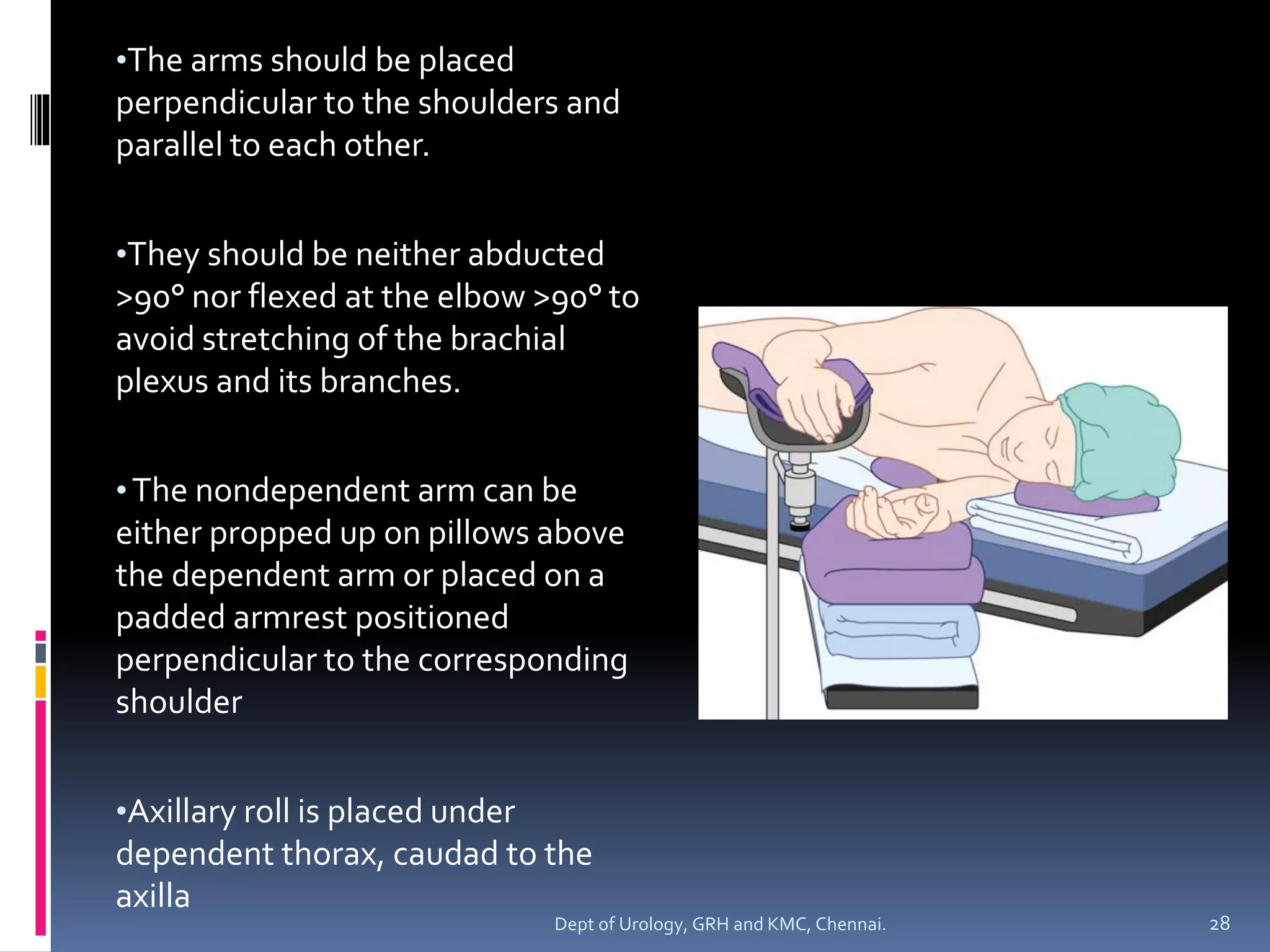 Positioning in urological procedures | PDF