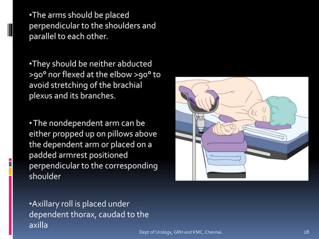 Positioning in urological procedures | PDF