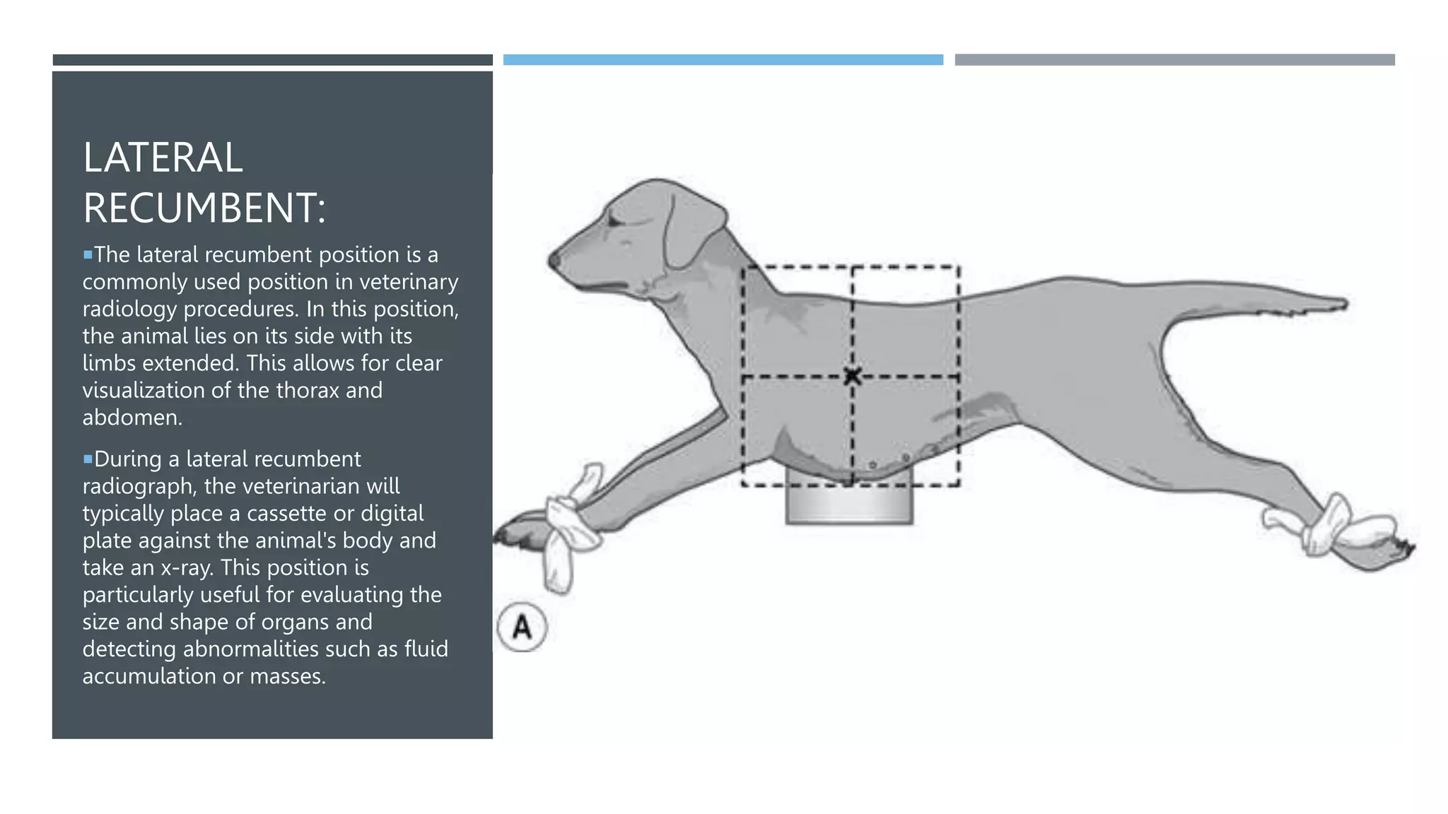 Positioning LRC - Radiology | PPTX