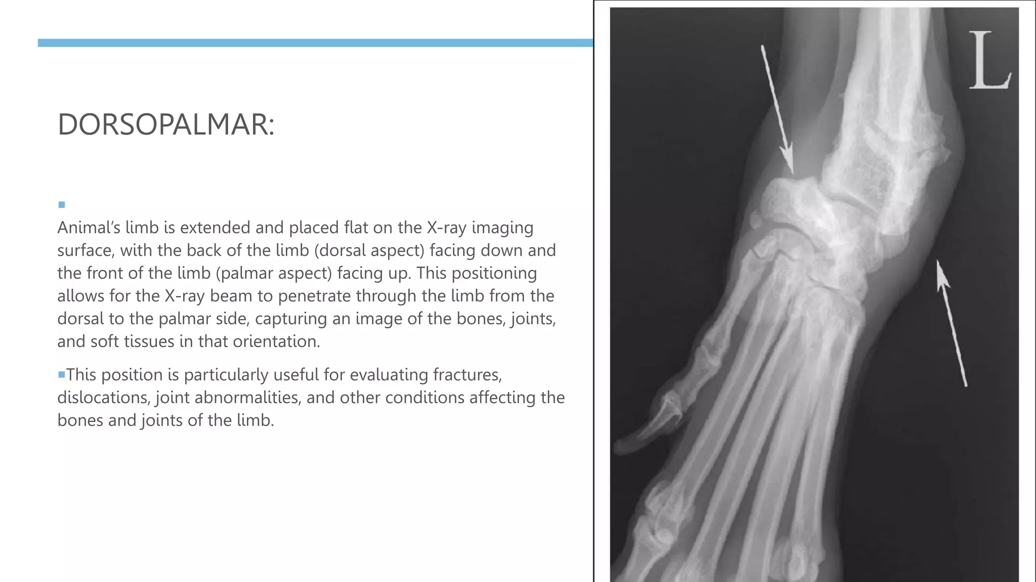 Positioning LRC - Radiology | PPTX