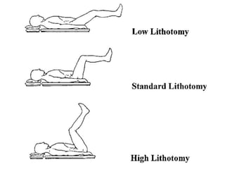 Low Lithotomy Position
