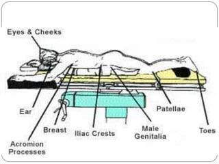 Positioning of perineal surgery | PPTX