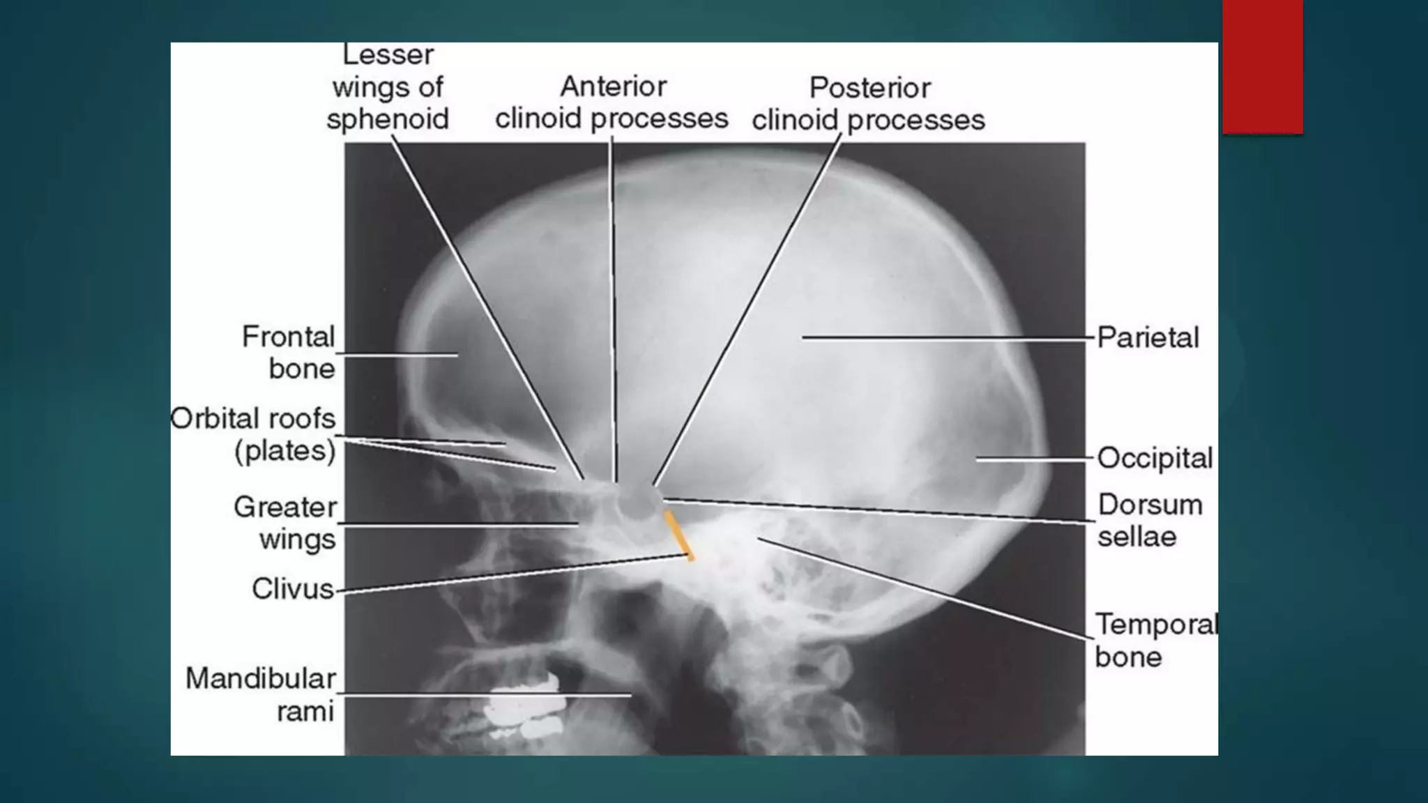 Positioning of skull | PPTX