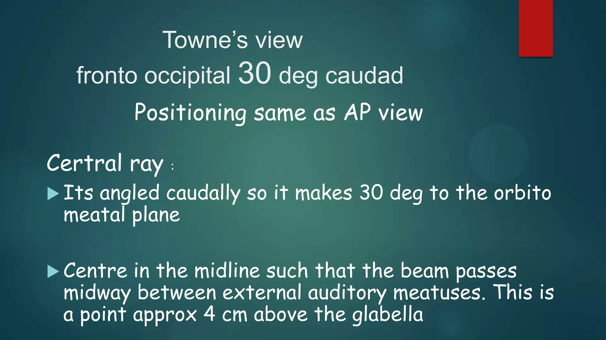 Positioning of skull | PPTX