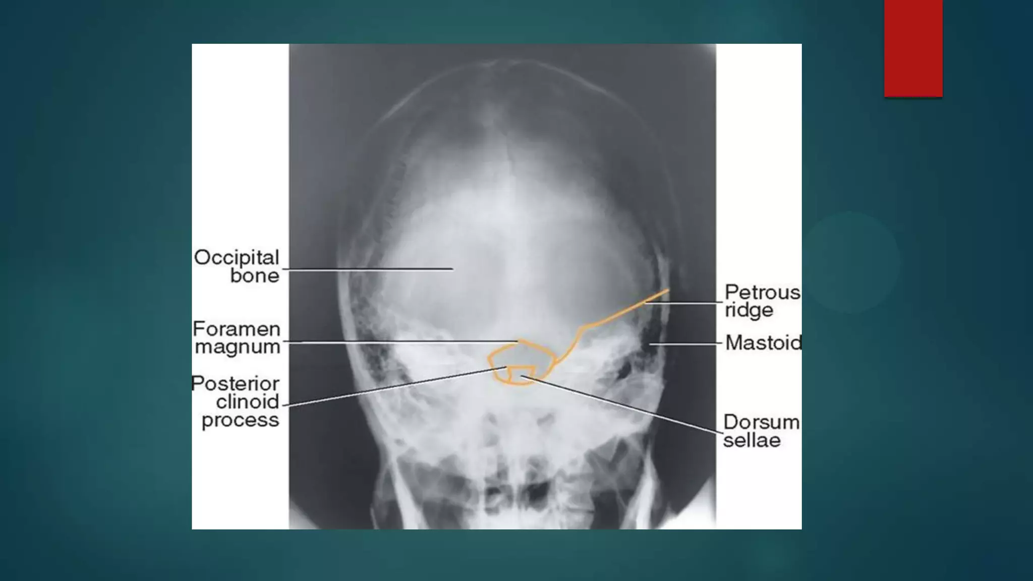 Positioning of skull | PPTX