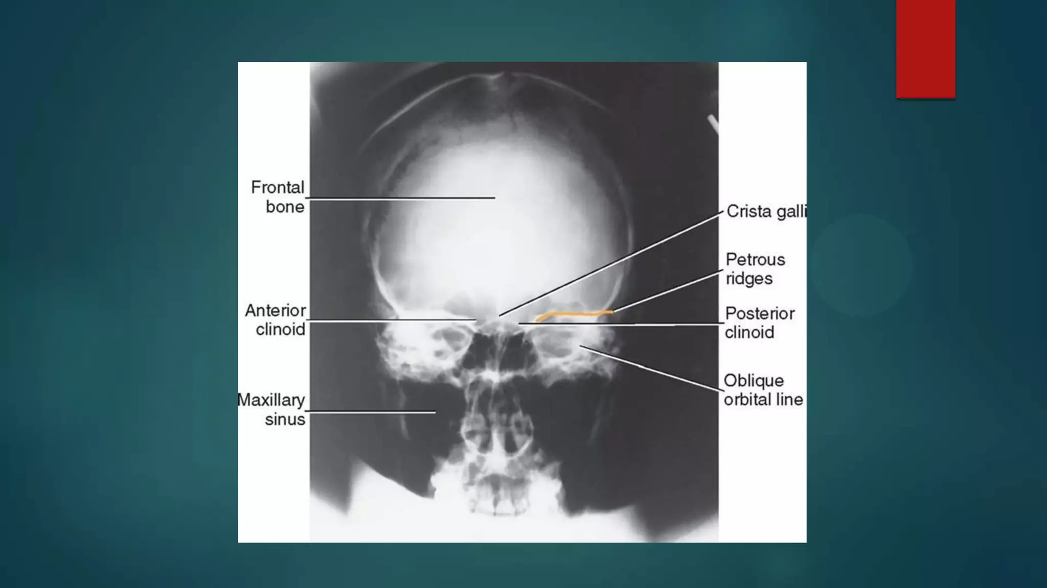 Positioning of skull | PPTX