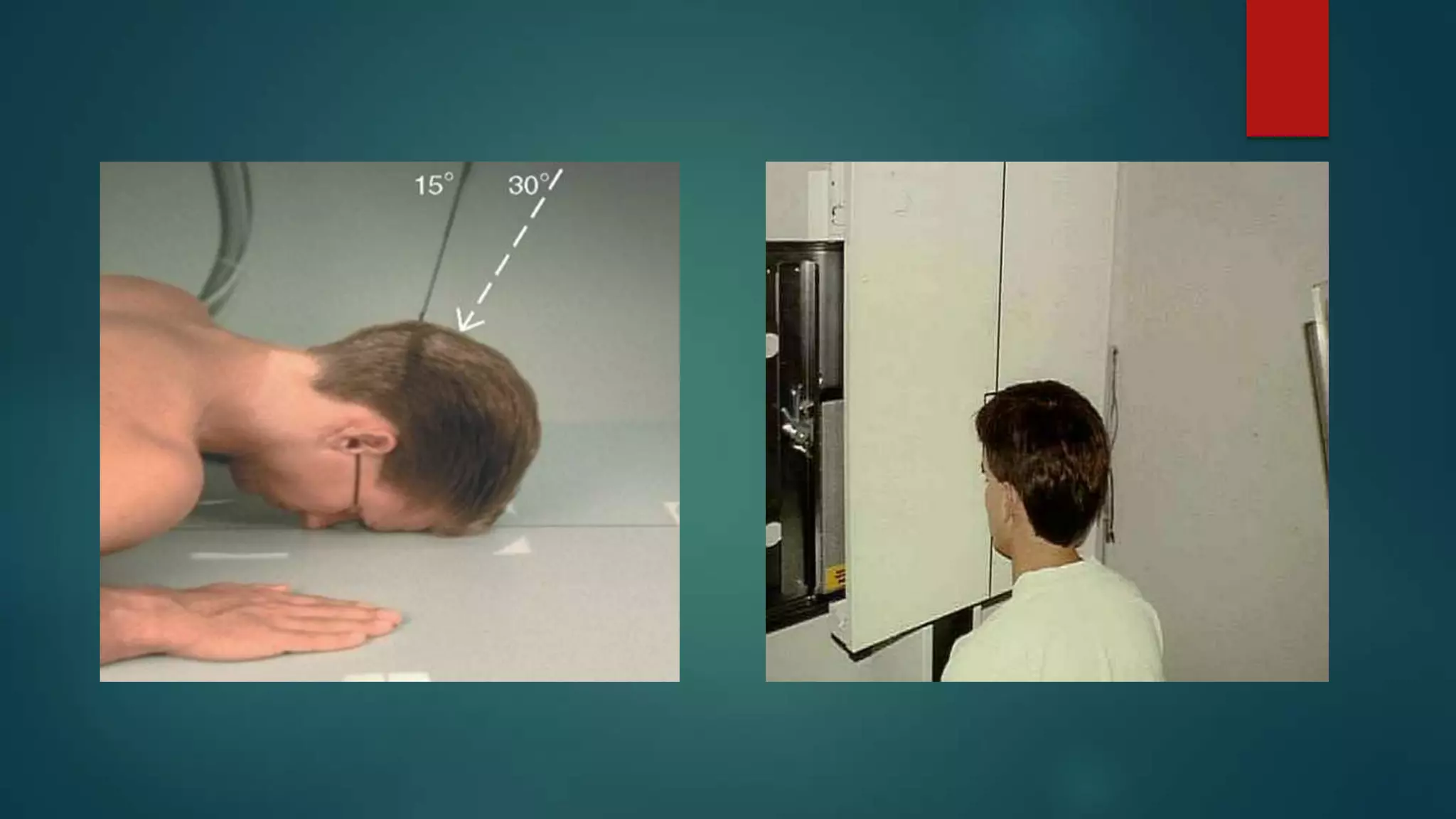 Positioning of skull | PPTX