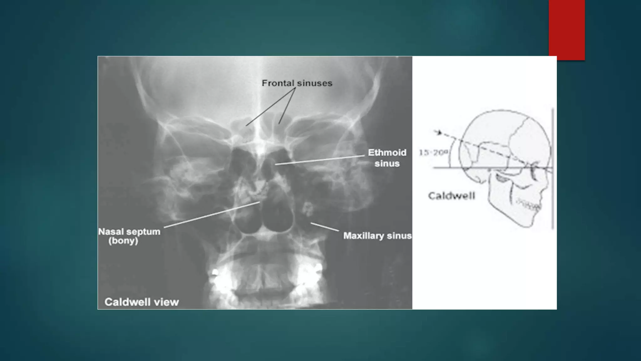 Positioning of skull | PPTX