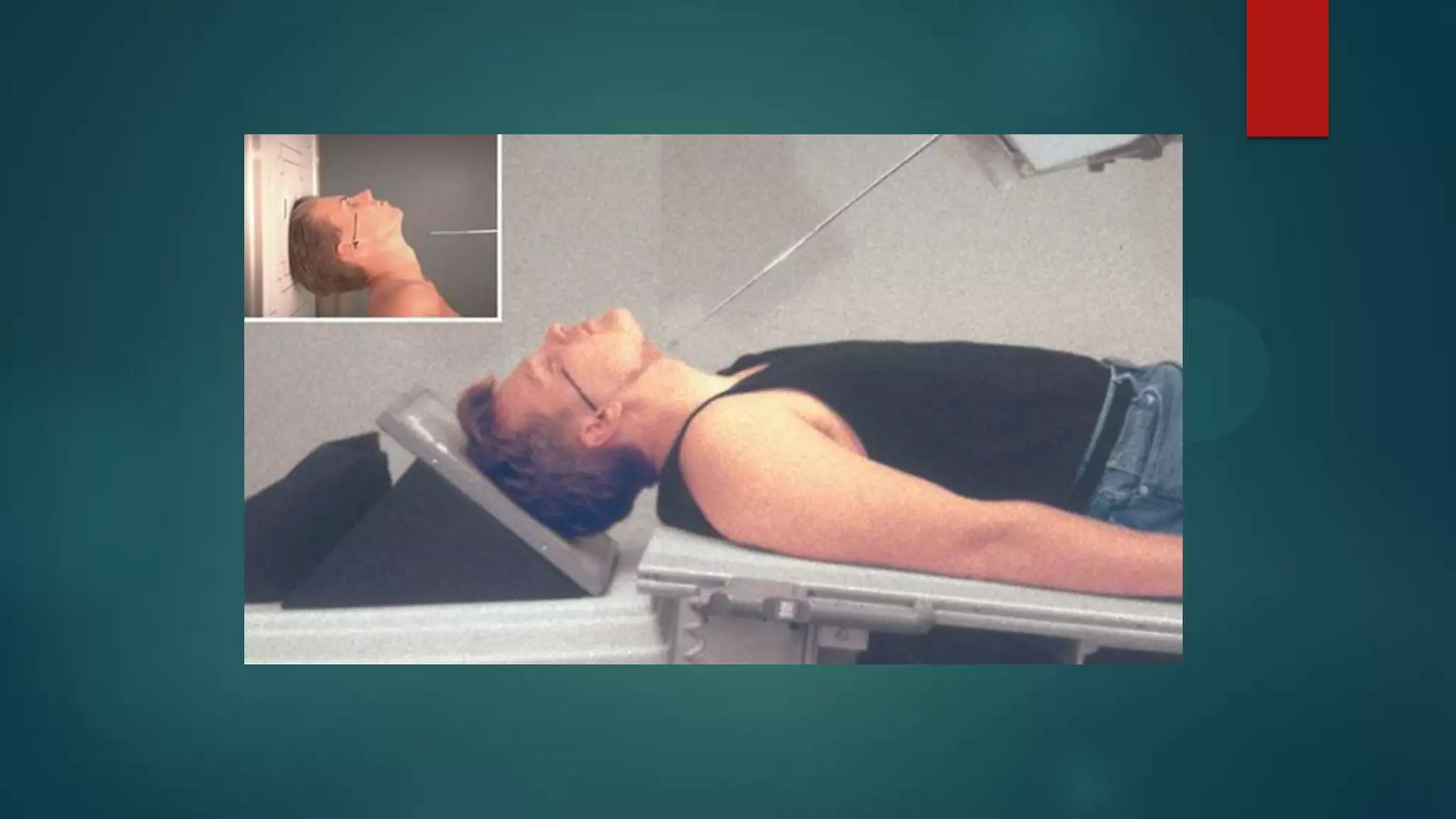 Positioning of skull | PPTX