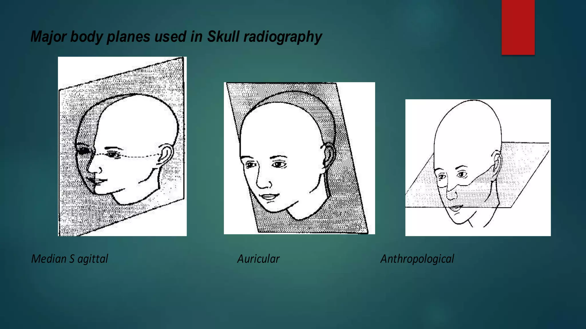 Positioning of skull | PPTX