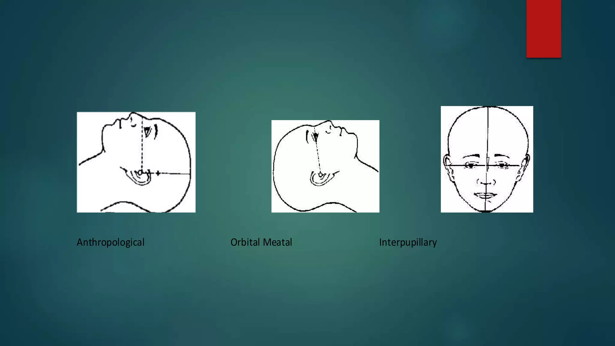 Positioning of skull | PPTX