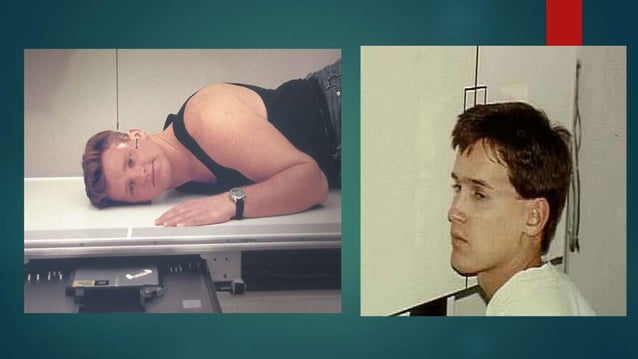 Positioning of skull | PPTX