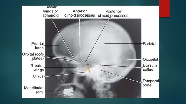 Positioning of skull | PPTX
