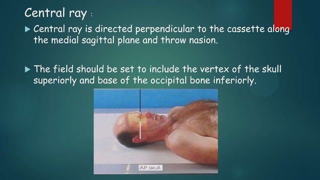 Positioning of skull | PPTX