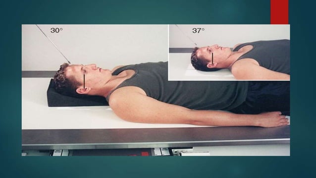 Positioning of skull | PPTX