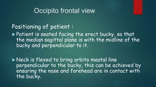 Positioning of skull | PPTX