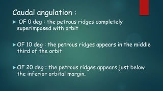 Positioning of skull | PPTX