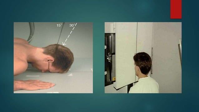 Positioning of skull | PPTX