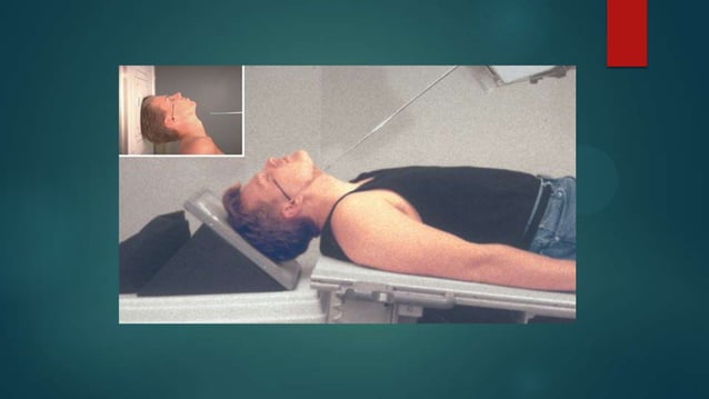 Positioning of skull | PPTX