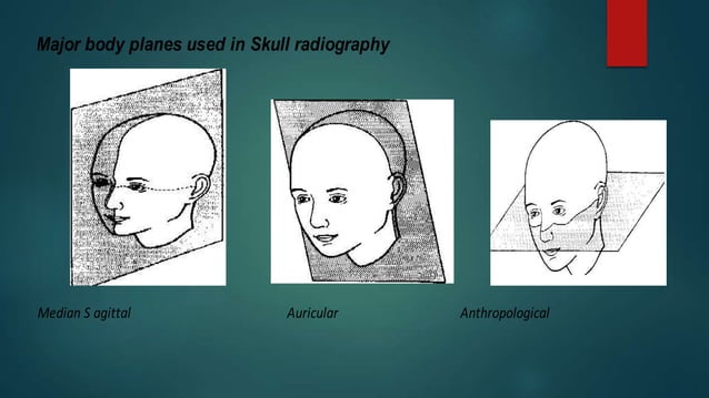 Positioning of skull | PPTX