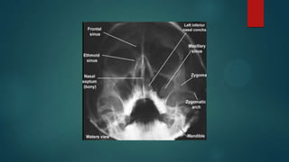 Positioning of skull | PPTX