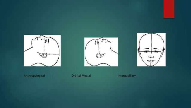 Positioning of skull | PPTX