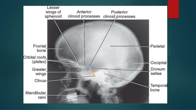 Positioning of skull