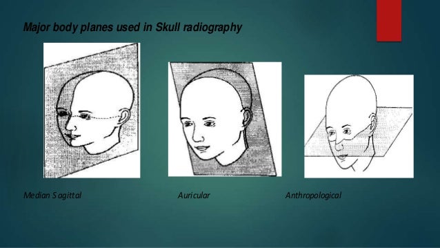 Positioning of skull