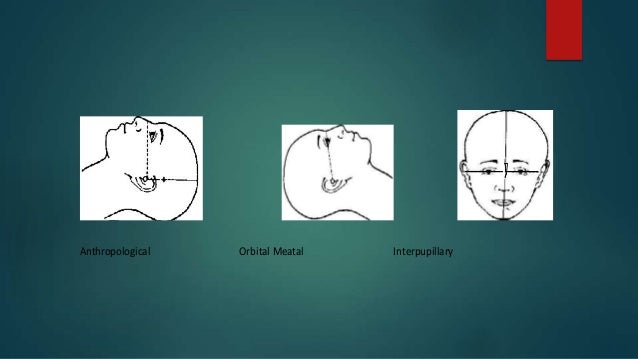 Positioning of skull