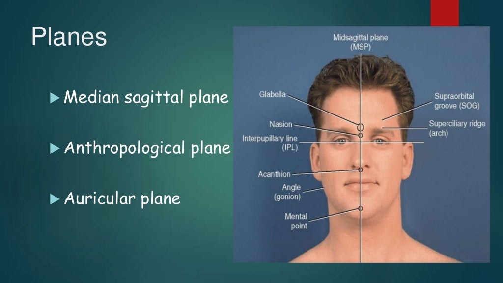 Positioning of skull
