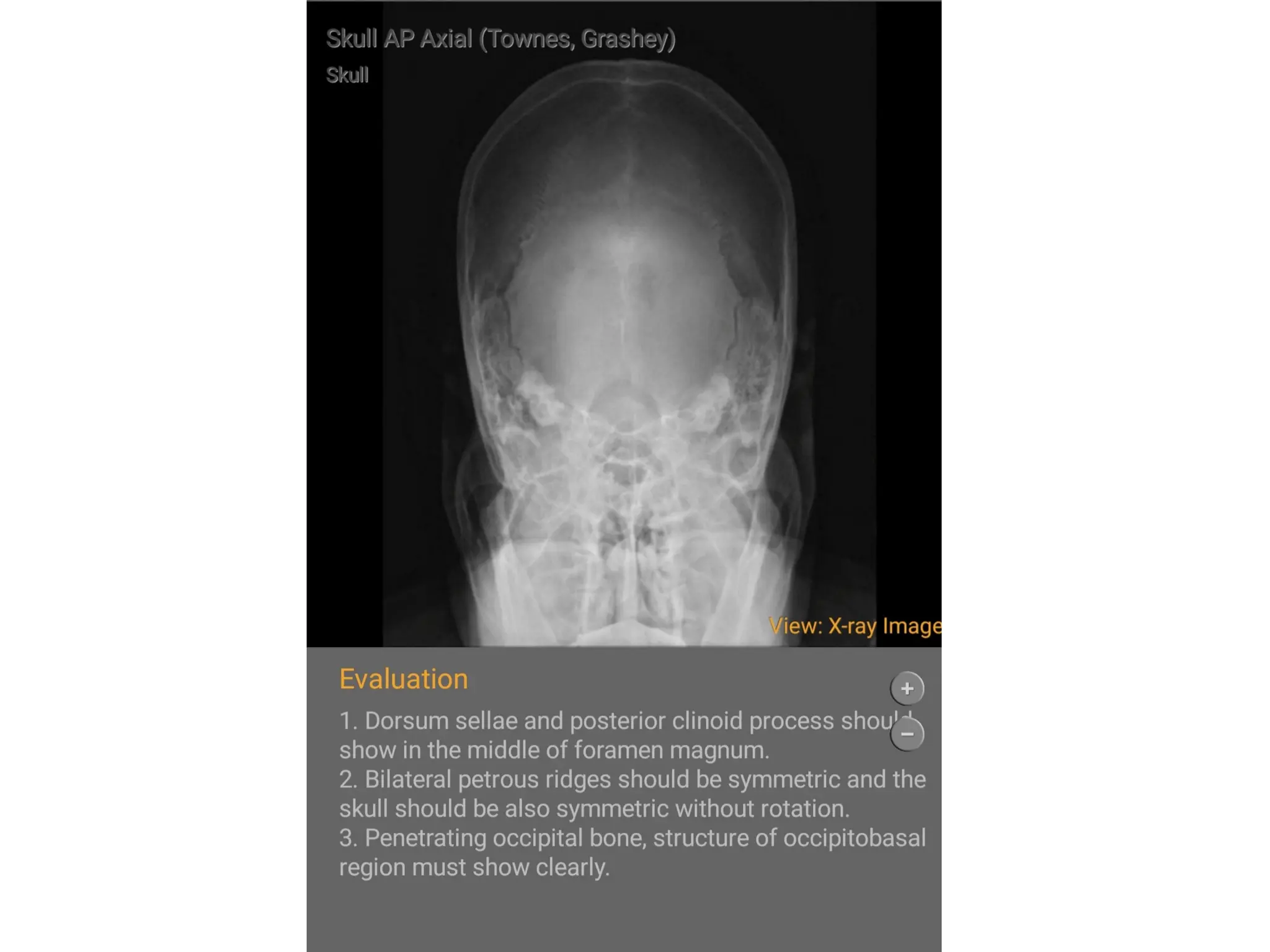 Positioning of Skull for X ray of PNS.pptx
