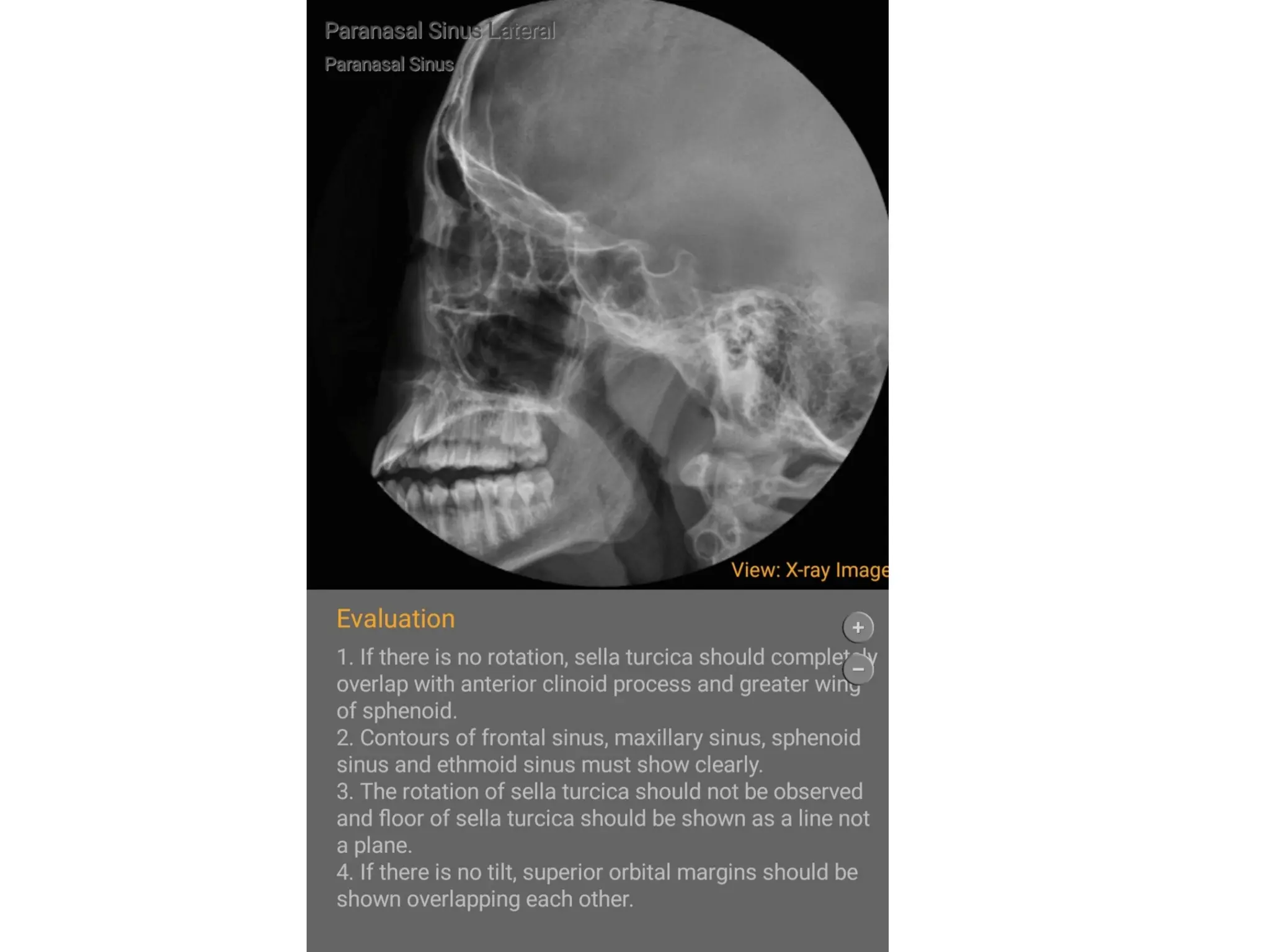 Positioning of Skull for X ray of PNS.pptx
