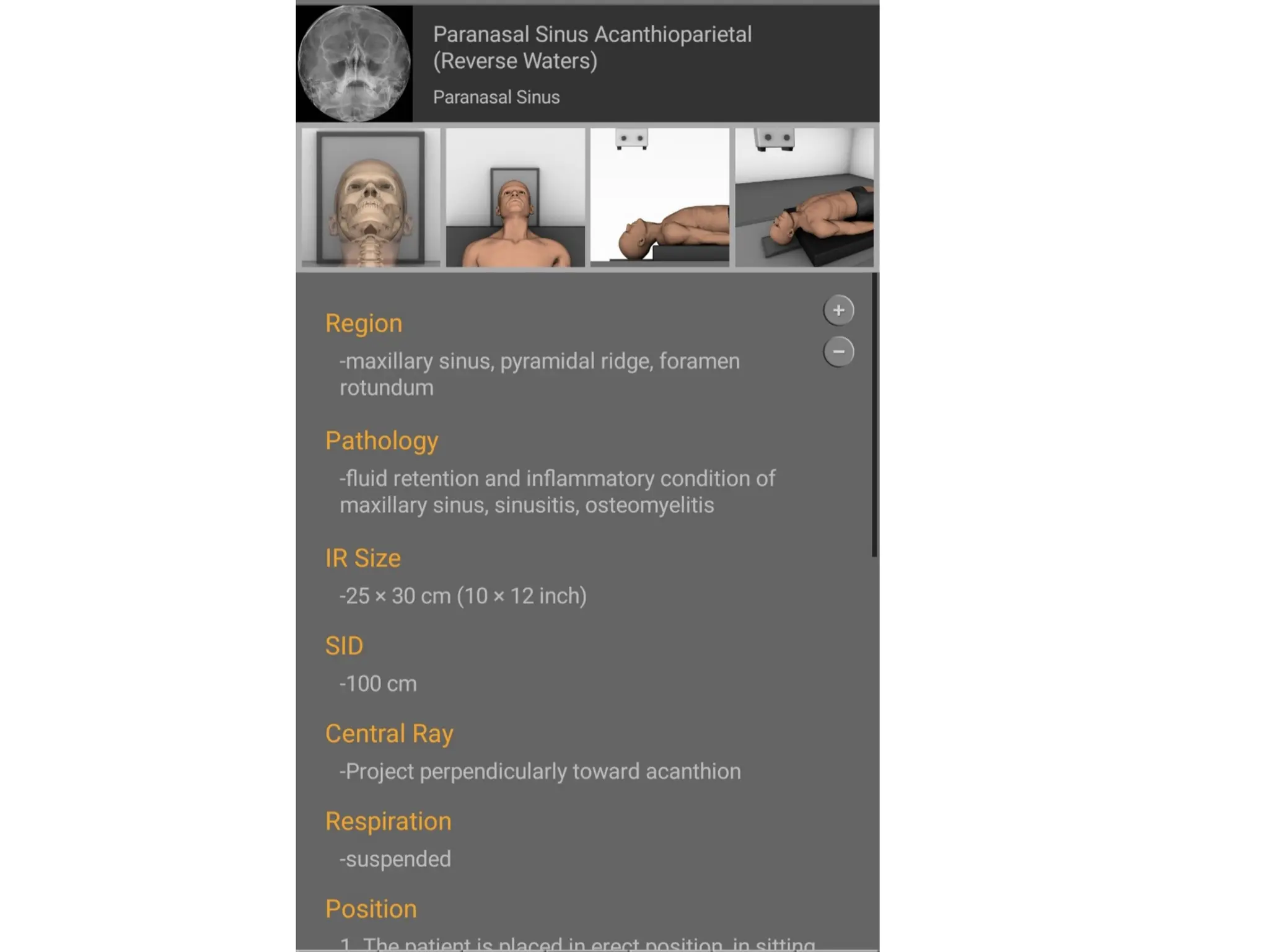 Positioning of Skull for X ray of PNS.pptx