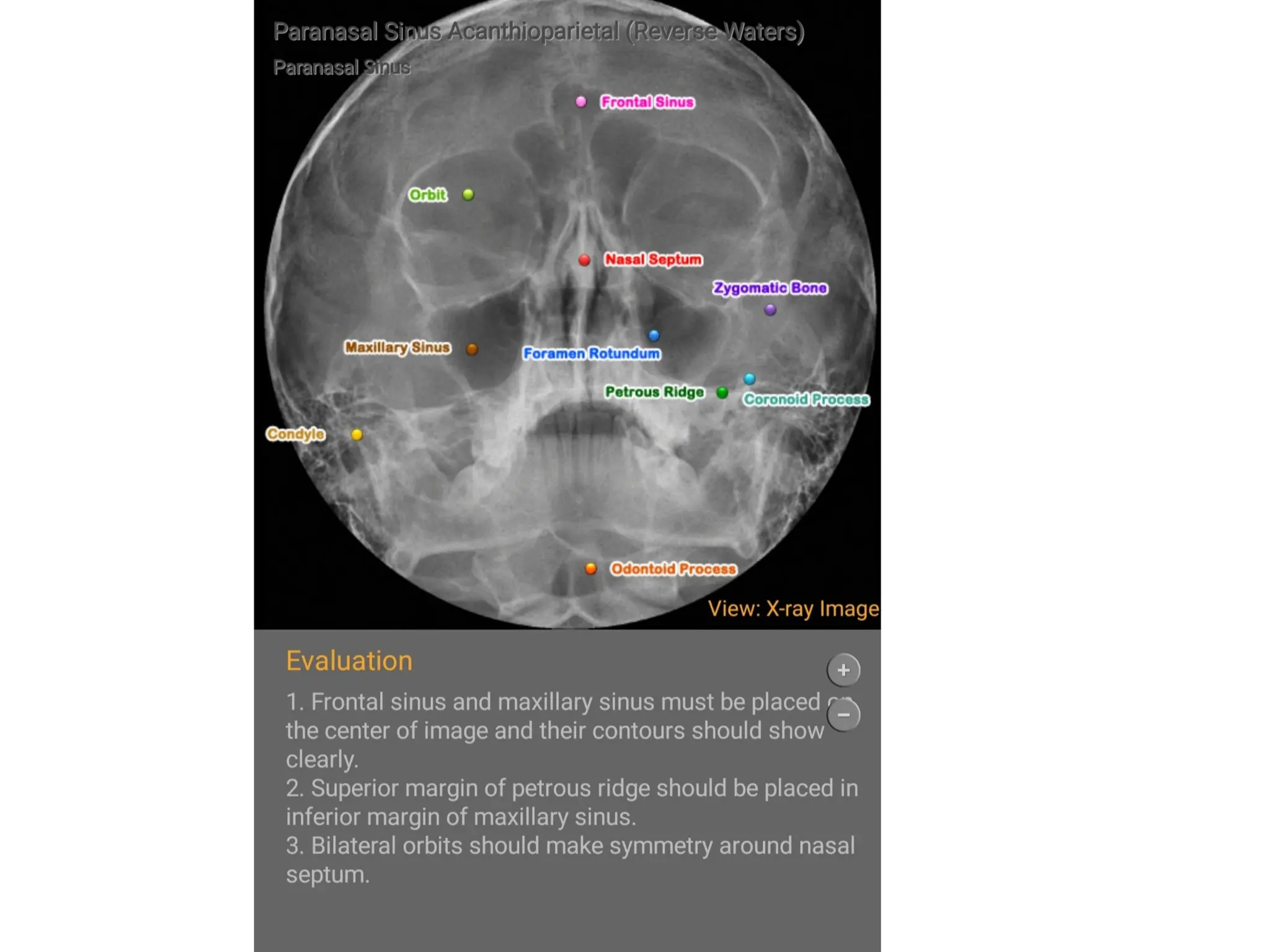 Positioning of Skull for X ray of PNS.pptx
