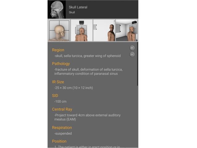 Positioning of Skull for X ray of PNS.pptx