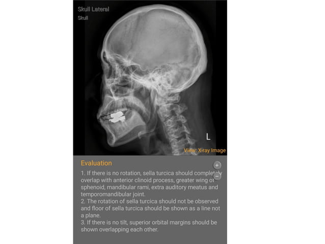 Positioning of Skull for X ray of PNS.pptx