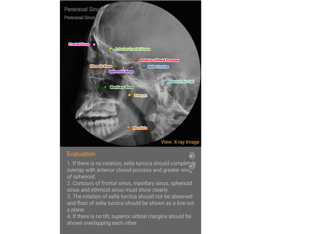 Positioning of Skull for X ray of PNS.pptx