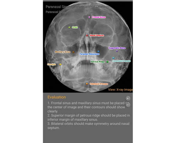 Positioning of Skull for X ray of PNS.pptx