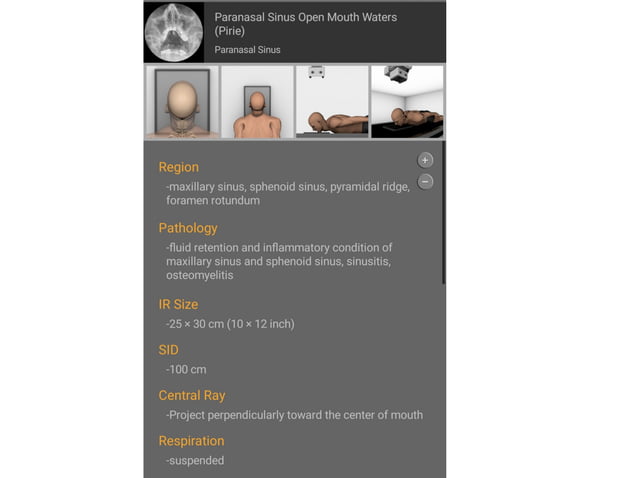 Positioning of Skull for X ray of PNS.pptx